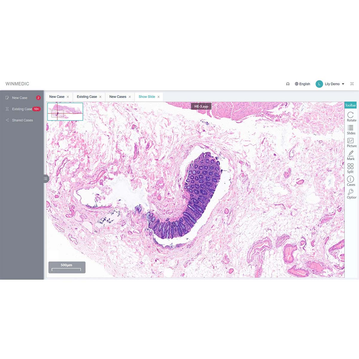 Remote Pathology Collaboration Solution - Winmedic Tech Co., Ltd.